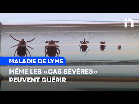 Maladie de Lyme: même les «cas sévères» peuvent guérir
