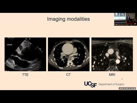 Cardiology Grand Rounds -Marko Boskovski, MD - October 9, 2025