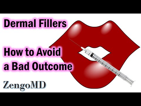 An Unbiased Look at Dermal Fillers -- How to Avoid a Bad Outcome -- ZengoMD