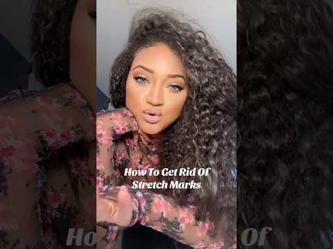 How To Get Rid Of Stretch Marks #stretchmarks #stretchmarksremoval #scars