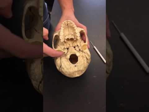 Anatomy I Episode 7: Temporal Bone and it's Structures - TEACHER T