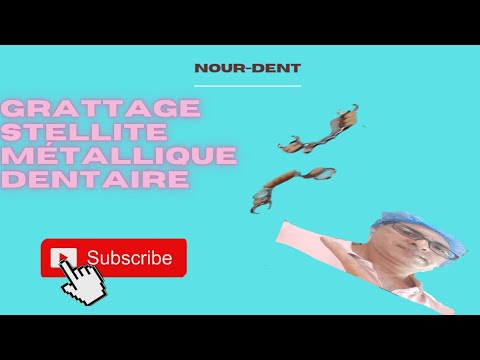 grattage stellite métallique dentaire. الشبكات المعدنية لي طاقم الاسنان