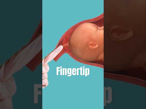 Membrane Sweep Procedure #pregnancy