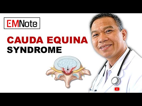 Cauda Equina Syndrome (CES)