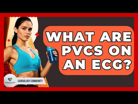 What Are PVCs On An ECG? - Cardiology Community