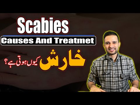 Scabies Ki Pehchan Aur Iska Ilaj \| Dr. Shoaib Ke Sath \| The Medbros \| خارش کا علاج |