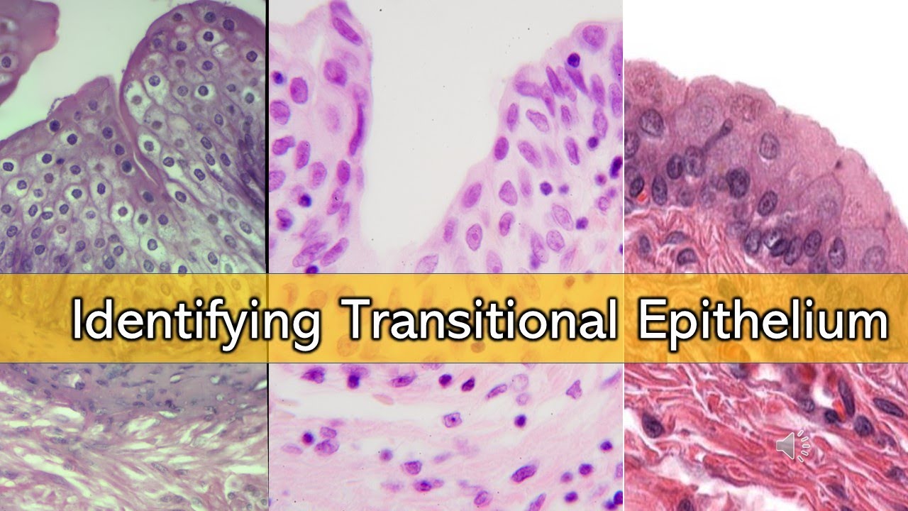 Identifying Transitional Epithelium