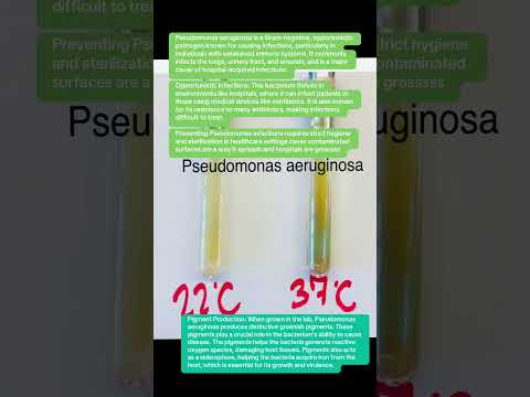 Pseudomonas aeruginosa is a harmful bacterium that can cause serious infections #Microbiology