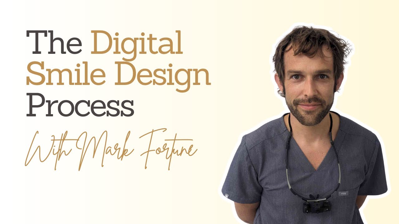 The Digital Smile Design Process