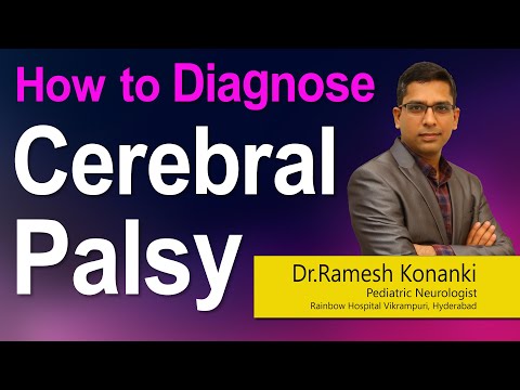 Hi9 | How to Diagnose Cerebral Palsy Dr Ramesh Konanki | Pediatric Neurologist