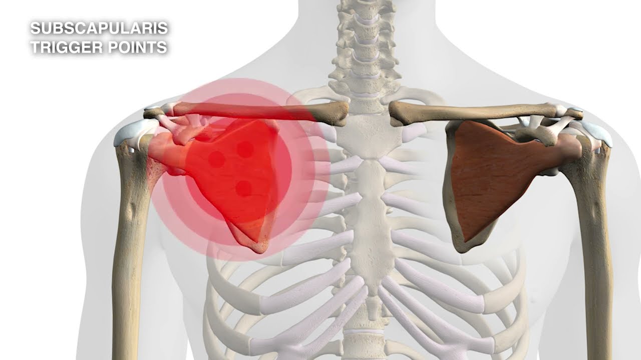Exploring the Subscapularis: Understanding Trigger Point Locations for Better Muscle Health