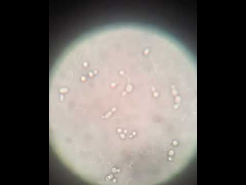 Candida albicans | Germ Tube Test | Budding yeast cells