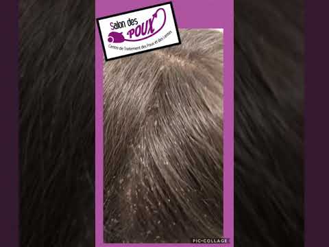 Salon des Poux - 40 rue Lemercier 75017 Paris - 01.71.27.41.42
