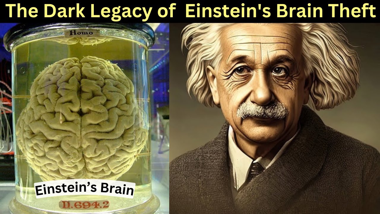 How Einstein's Stolen Brain Changed History Forever ?