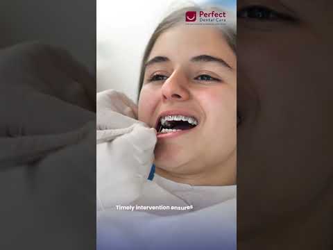 Braces Essentials | Perfect Dental Care