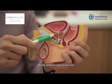 What is a retzius sparing robotic prostatectomy vs conventional robotic prostatectomy?
