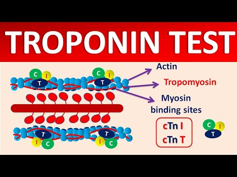 Troponin test and it's significance