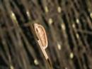 Lice - Mayo Clinic