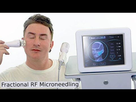 MNRF Machine - Microneedling Machine Latest Price, Manufacturers ...