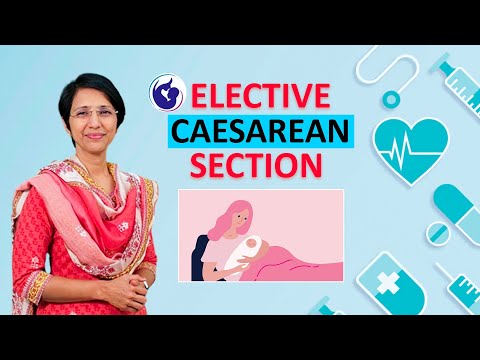 What is Elective C Section (Cesarean section) – Dr. Rajeshwari Reddy Explains