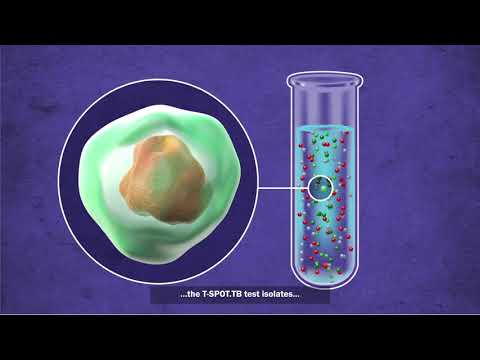 What is the T-SPOT.TB test?