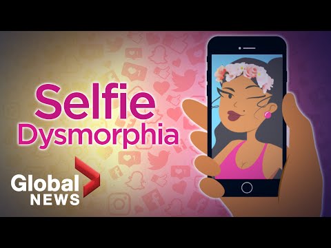 Selfie Dysmorphia: How social media filters are distorting beauty π€³π½