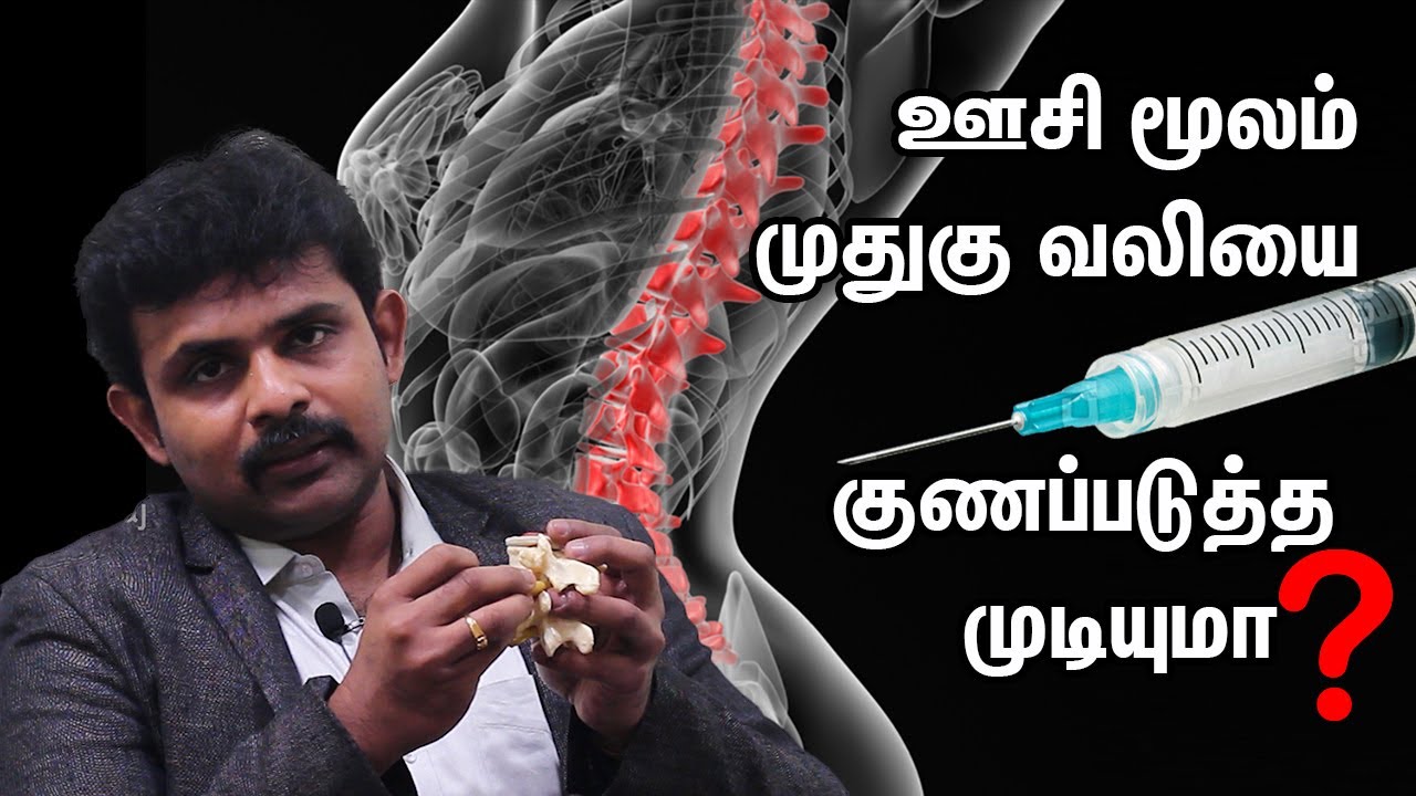 Can Back Pain Be Cured With Injections? Dr. Vignesh Pushparaj | Selective Nerve-Root Block