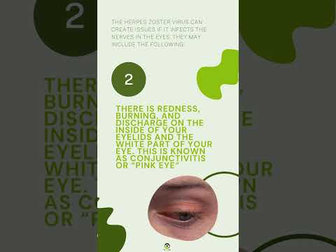 What Is The Impact Of Shingles On The Eye?