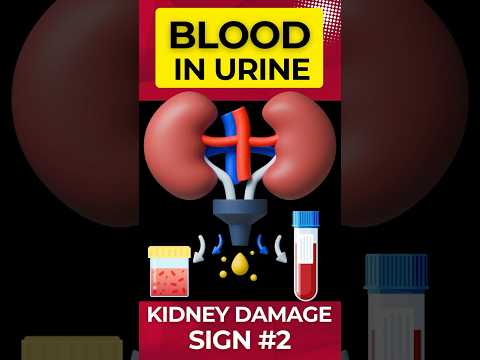 Bloody Urine Is NOT Normal—It Could Signal Kidney Failure
