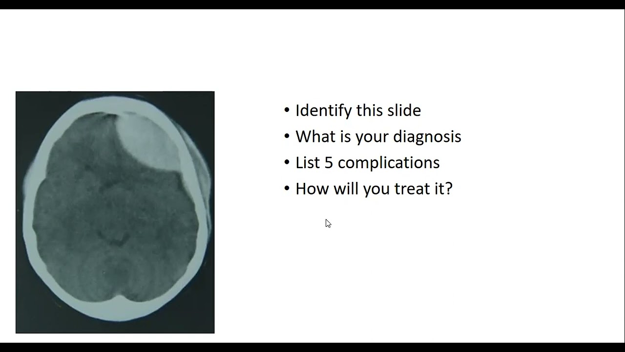 OSCE IN SURGERY