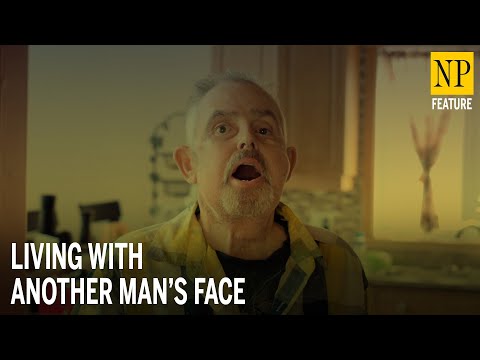 Living with another man's face