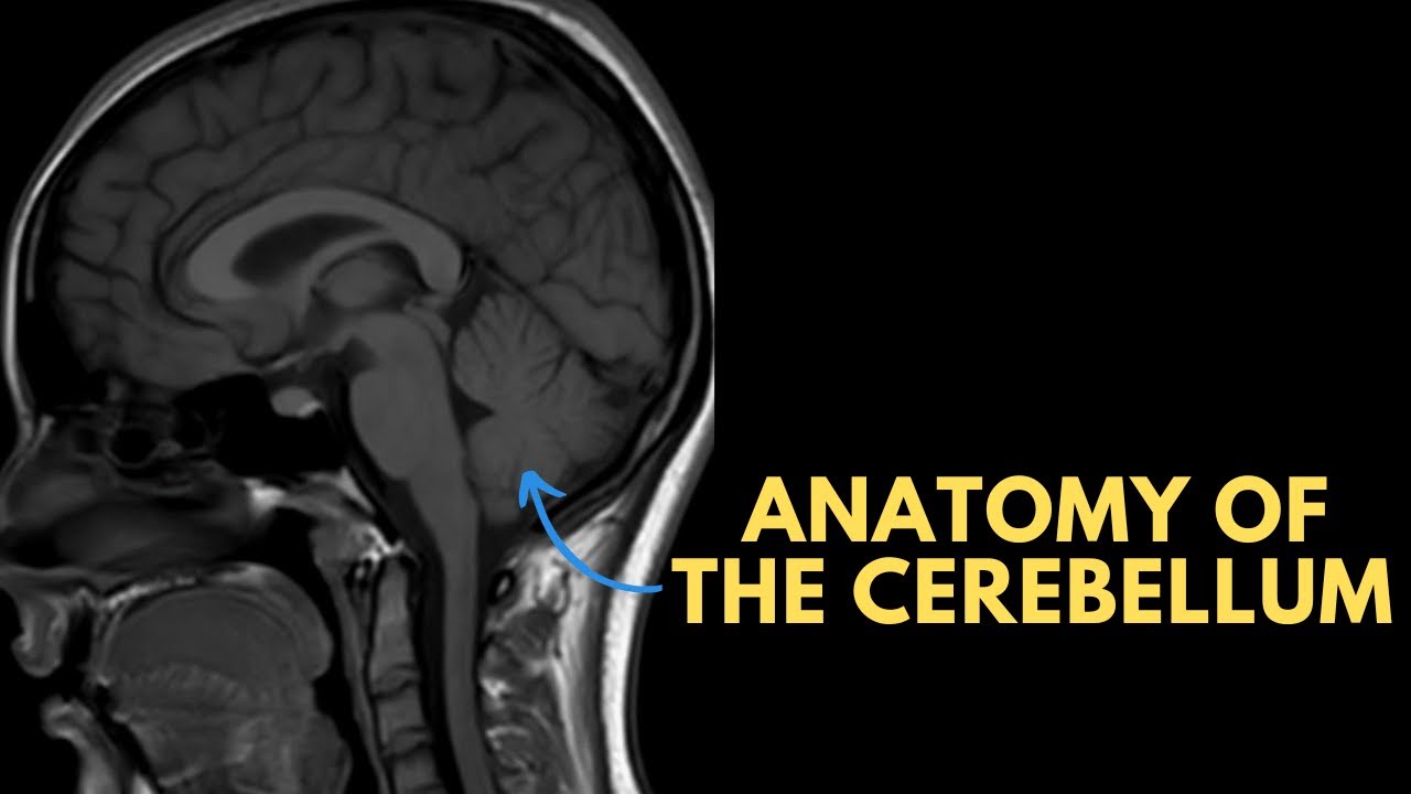 Anatomy of the cerebellum on MRI