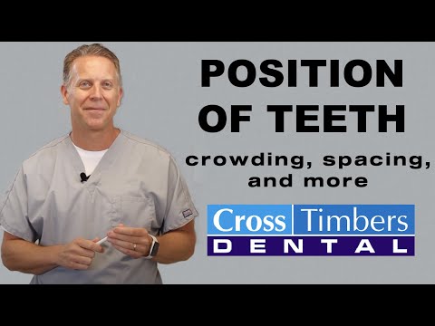 Position of teeth: The Cosmetic Quadrant