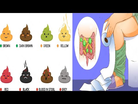 Stools colors , When to worry , What poops colors mean and show about your health ?