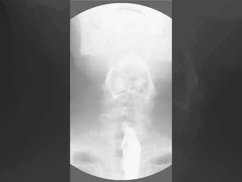 Barium - The Element of Brightness and Health