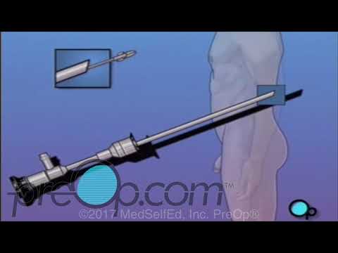 Male Cystoscopy Procedure | PreOp® Patient Education – Medicine by ...