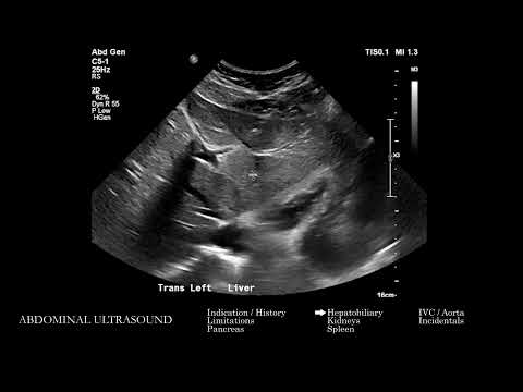 [US] Abdominal Ultrasound | Search Pattern
