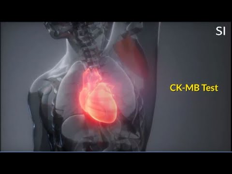 What is Creatine Kinase MB (CK-MB)?
