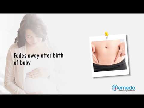Linea nigra eng app