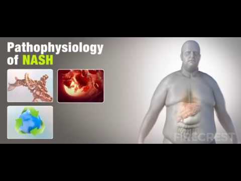 FIRECREST Medical Animations: Non alcoholic Steatohepatitis (NASH)