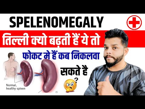 Spleen क्यों बढ़ता है 🔥 Splenomegaly In Hindi / Causes And What Happen If Remove Spleen / Gyanear