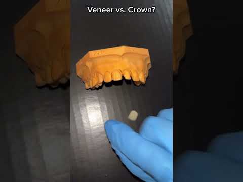 Veneers Course at Prep Doctors! www.prepdoctors.ca to register 🔗🦷 #dentist #teeth #veneer #crown