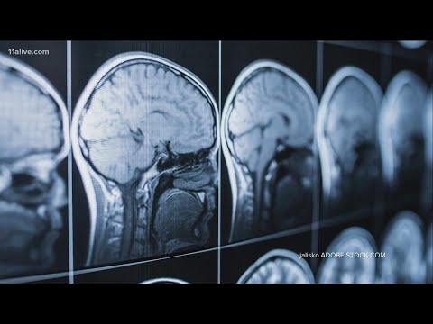 Study find CTE in 92% of former NFL players