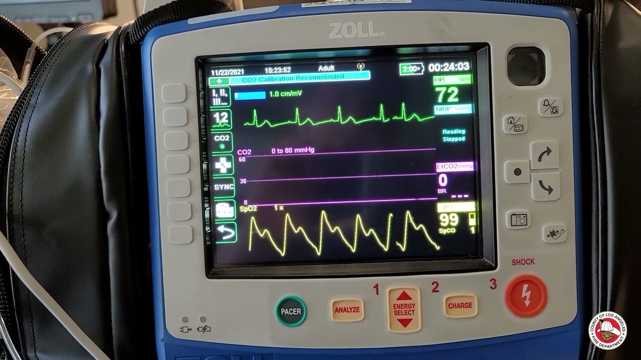 Capnography vs. Pulse Ox Apnea