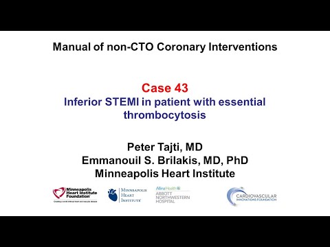 Case 43: PCI Manual - STEMI in a patient with essential thrombocytosis