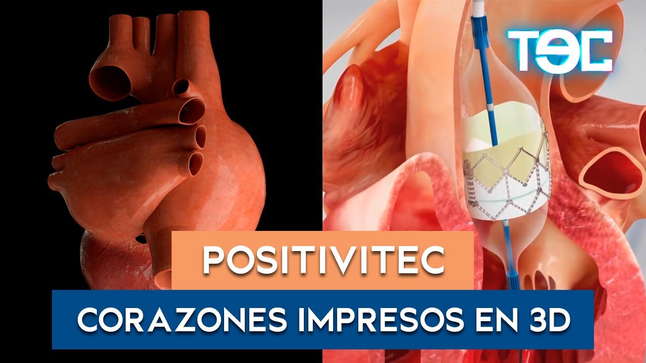POSITIVITEC: CORAZONES IMPRESOS EN 3D