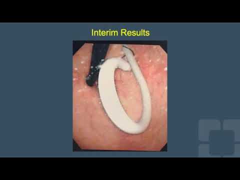 #201 UroMonitor Catheter-Free Wireless Ambulatory Cystometry is Feasible, Safe, and Well-Tolerated