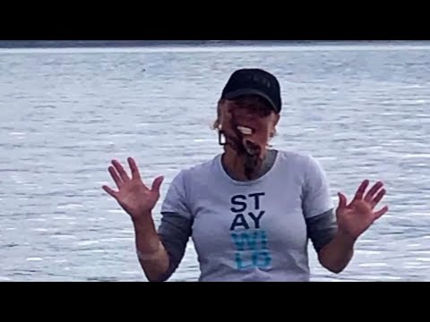 Woman Ends Up in Hospital After Putting an Octopus on Her Face