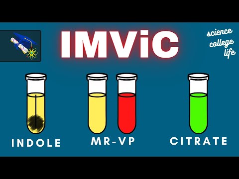 IMViC Test | Indole MR-VP Citrate | Microbiology Lab
