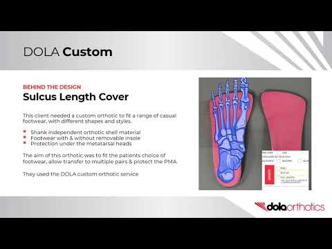 Sulcus Top Cover Length DOLA Orthotics Orthotips